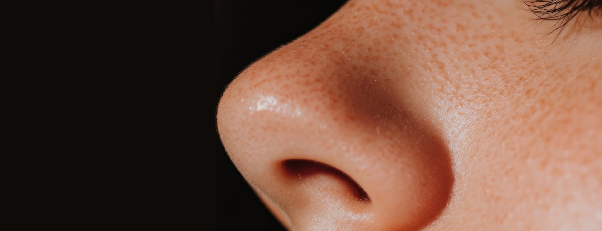 Découvrez les différentes anomalies du nez | Lyon | Dr Durbec